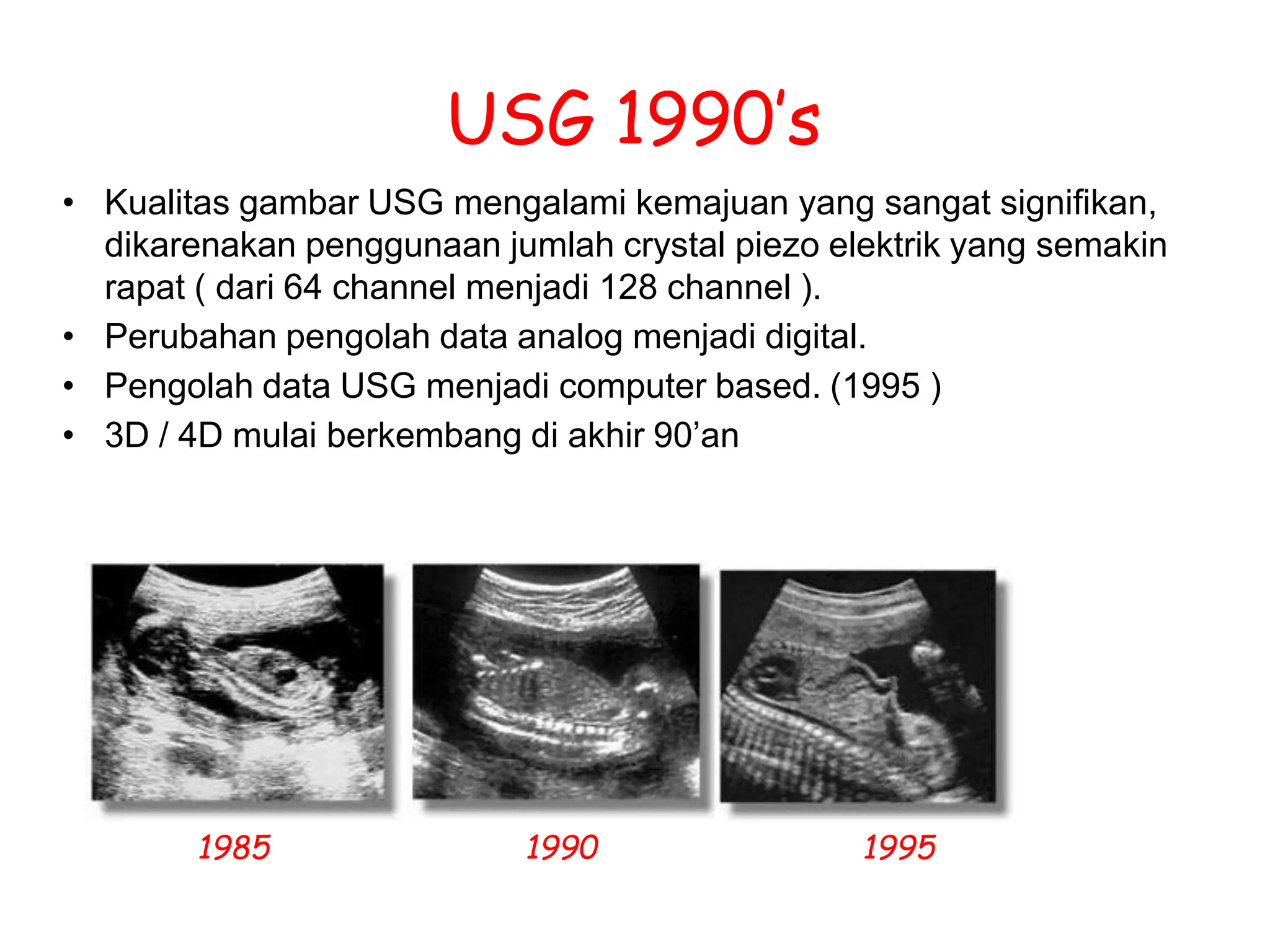 Sejarah dan Perkembangan USG (1).pptx
