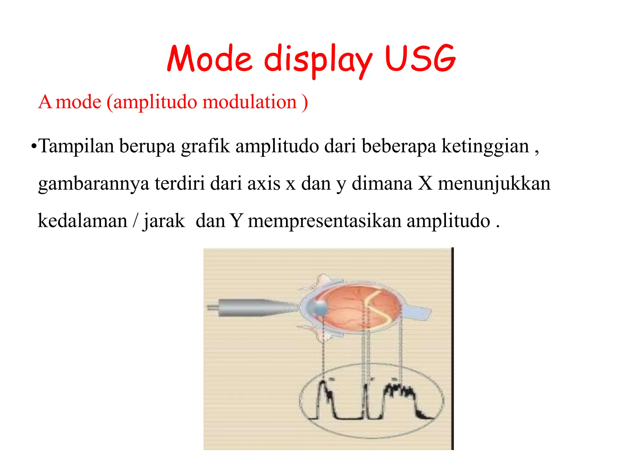 Sejarah dan Perkembangan USG (1).pptx