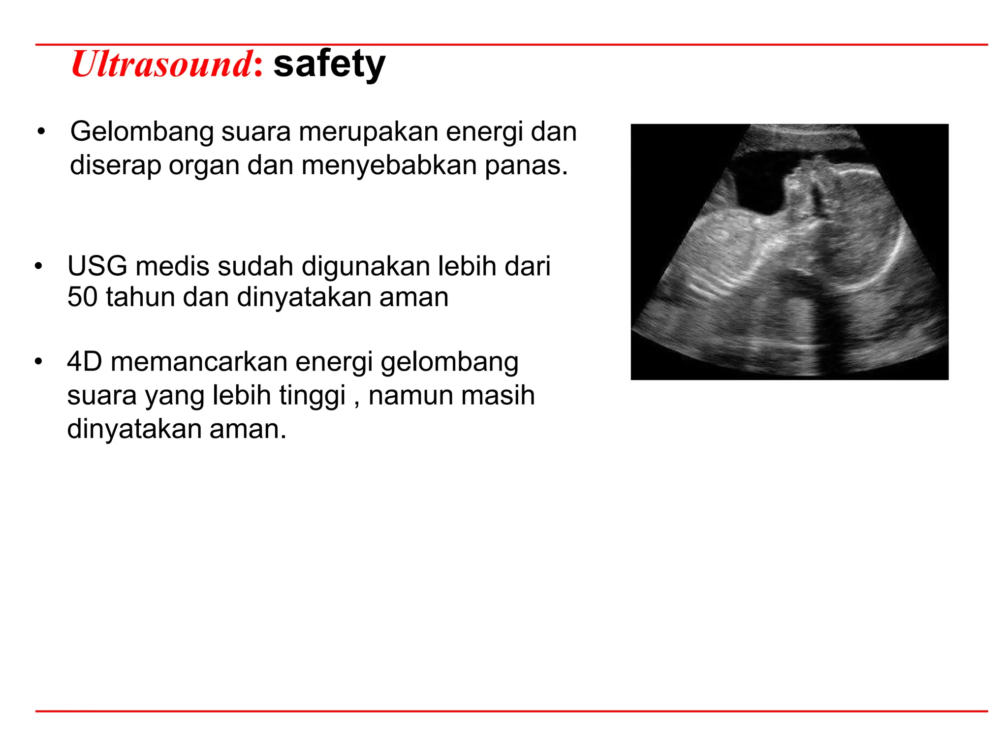 Sejarah dan Perkembangan USG (1).pptx