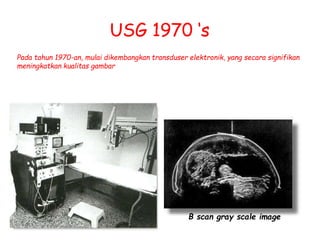 Sejarah dan Perkembangan USG (1).pptx