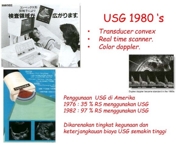 Sejarah dan Perkembangan USG (1).pptx