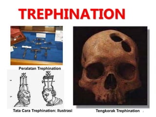SEJARAH PSIKOLOGI ABNORMAL.ppt