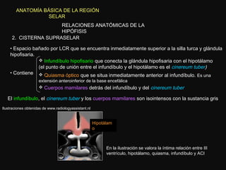Ubicación De La Cisterna Supraselar