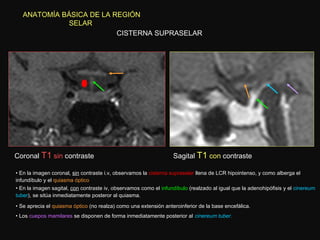 Anatomia de region selar | PPT