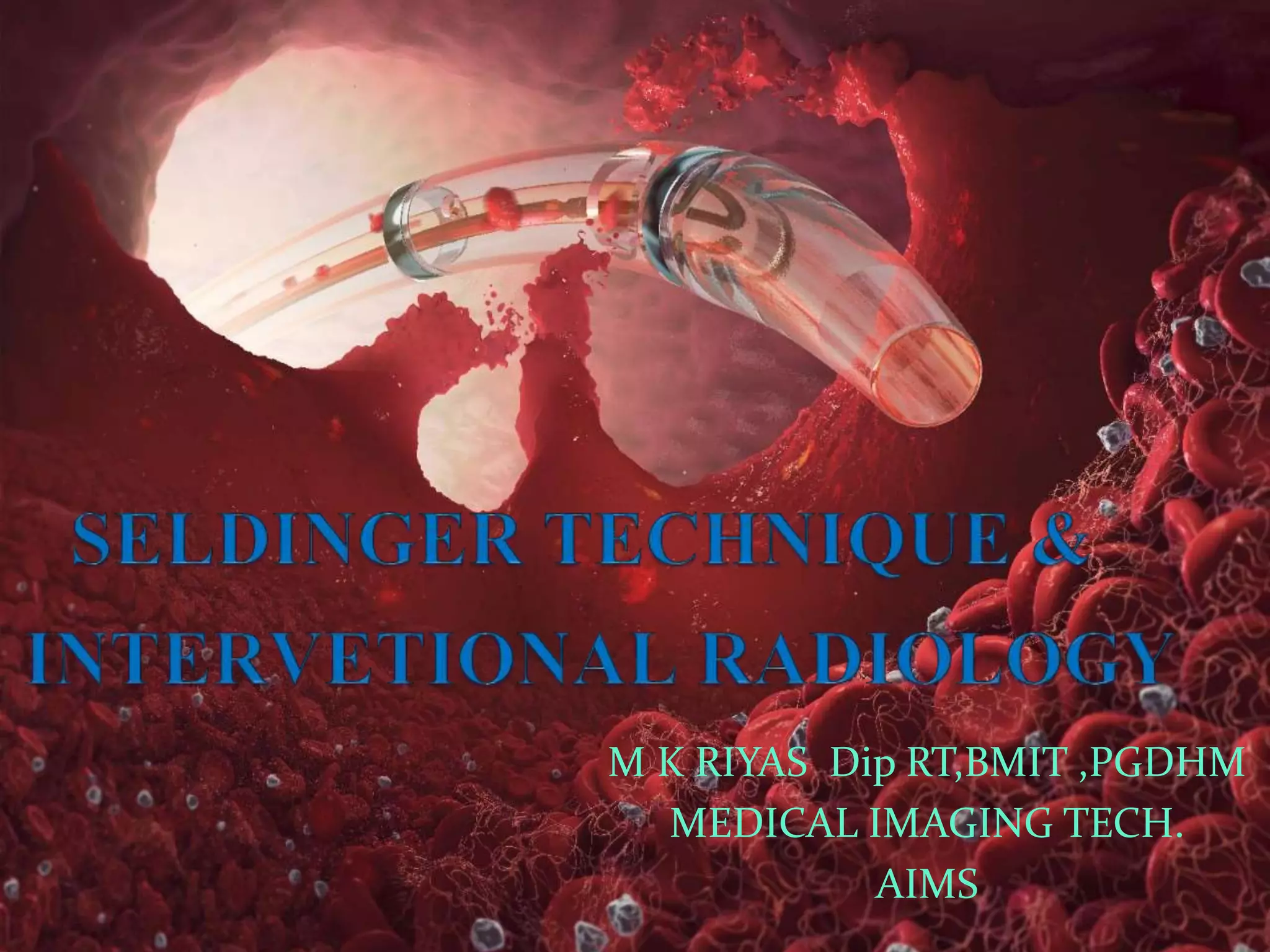 SELDINGER TECHNIQUE & INTERVENTIONAL RADIOLOGY | PPTX