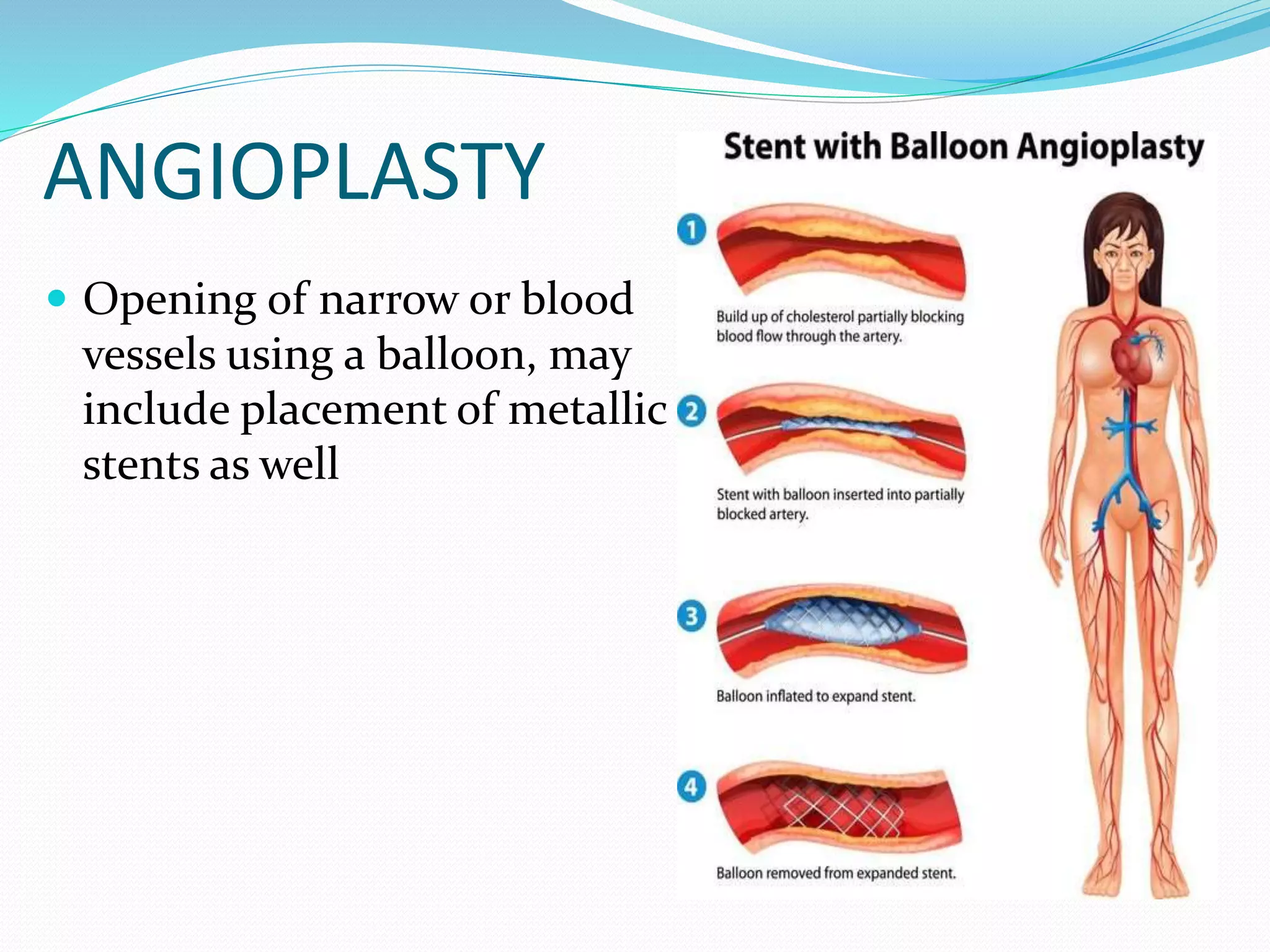 SELDINGER TECHNIQUE & INTERVENTIONAL RADIOLOGY | PPTX