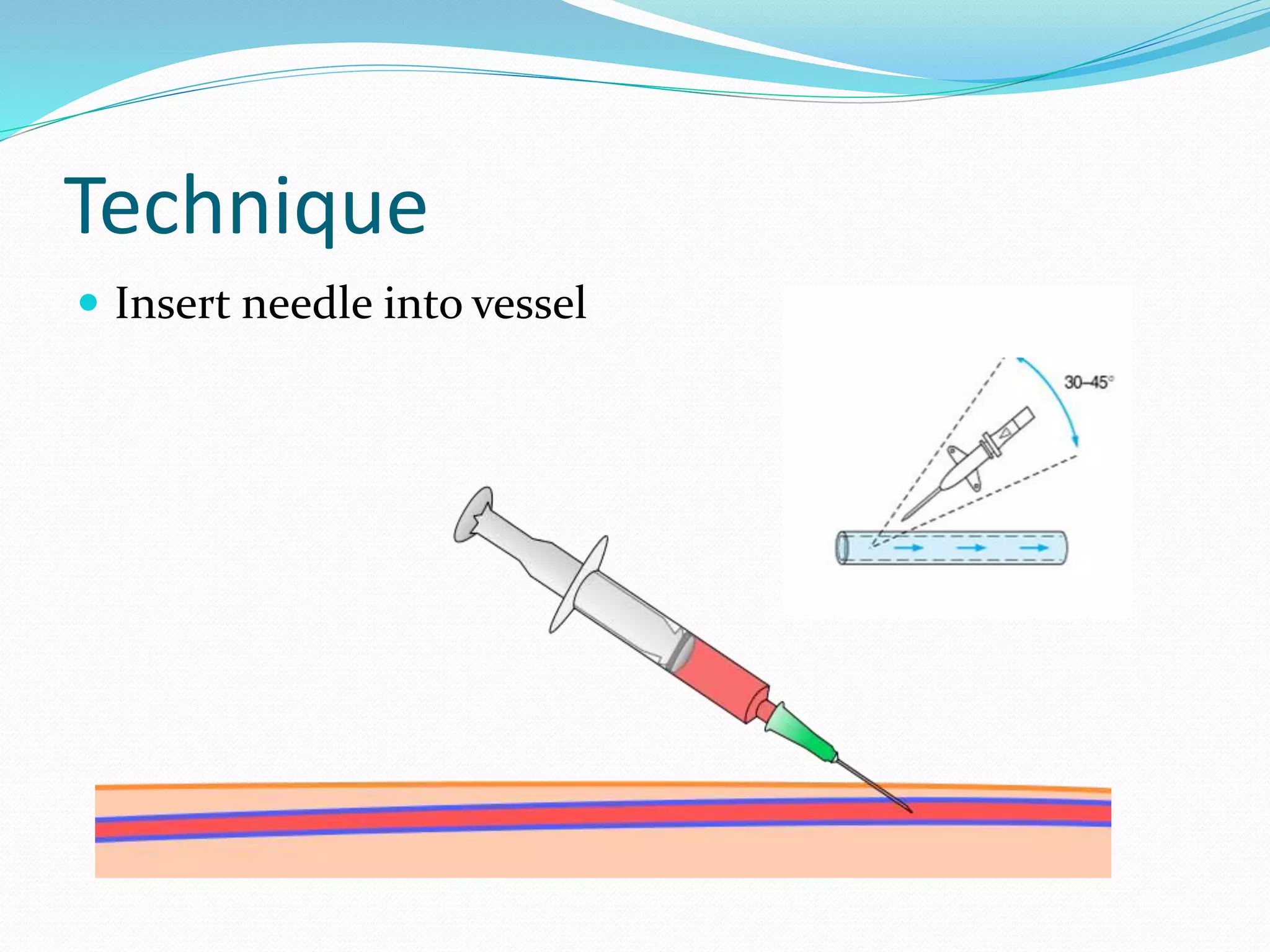 SELDINGER TECHNIQUE & INTERVENTIONAL RADIOLOGY | PPTX