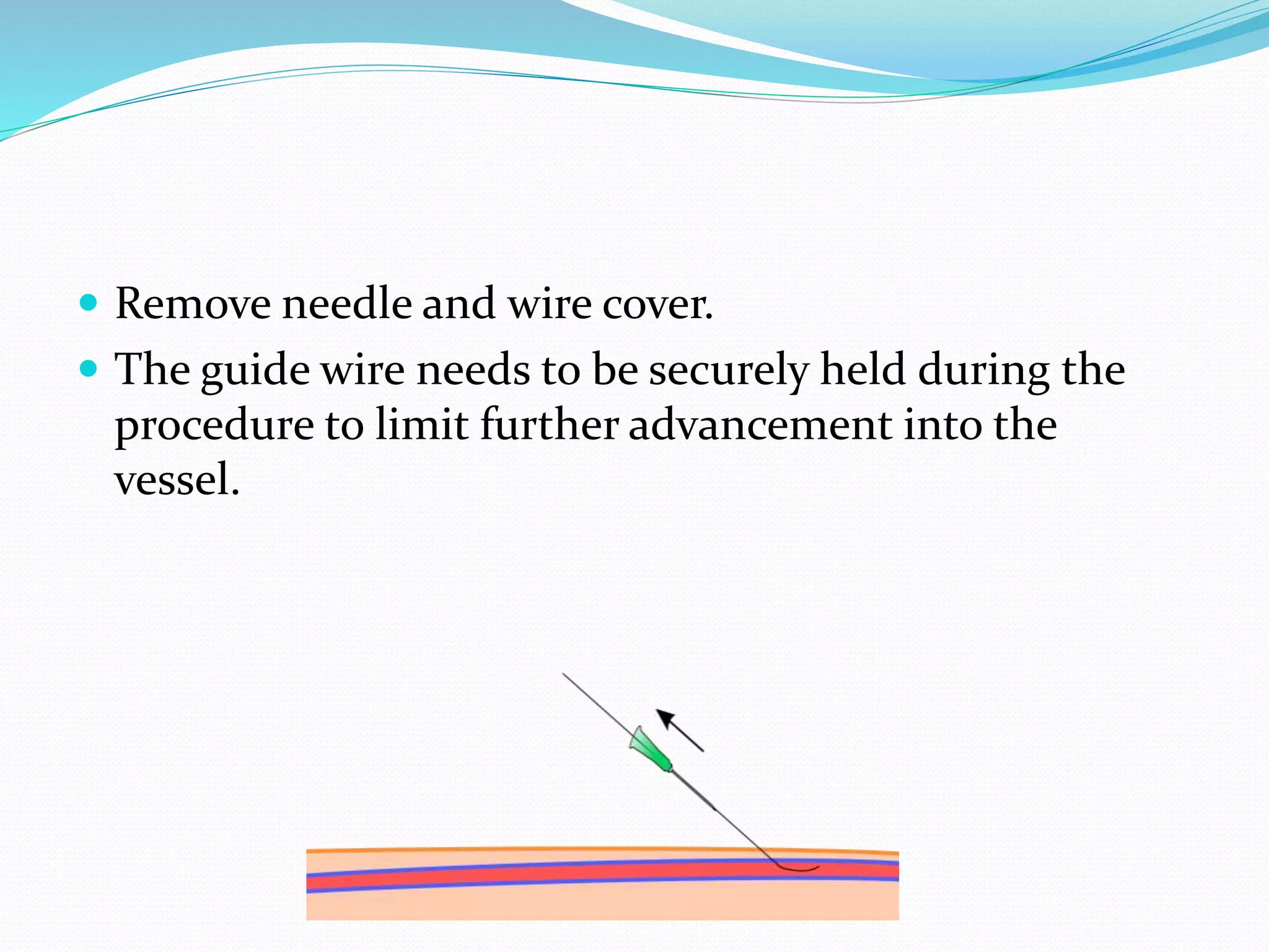 SELDINGER TECHNIQUE & INTERVENTIONAL RADIOLOGY | PPTX