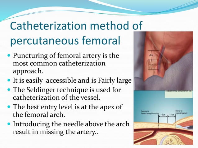 SELDINGER TECHNIQUE & INTERVENTIONAL RADIOLOGY | PPTX | First Aid ...