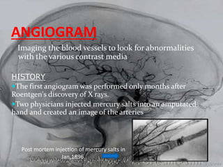 SELDINGER TECHNIQUE & INTERVENTIONAL RADIOLOGY | PPTX