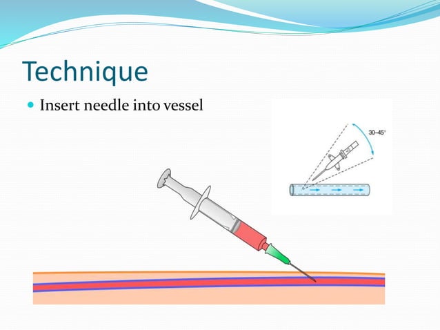 SELDINGER TECHNIQUE & INTERVENTIONAL RADIOLOGY | PPTX | First Aid ...