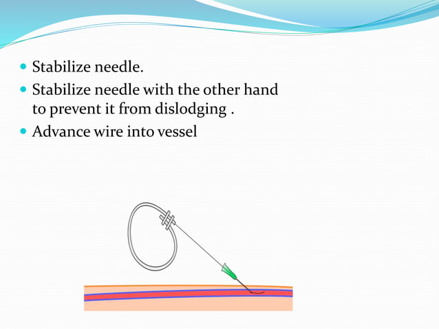 SELDINGER TECHNIQUE & INTERVENTIONAL RADIOLOGY | PPTX | First Aid ...