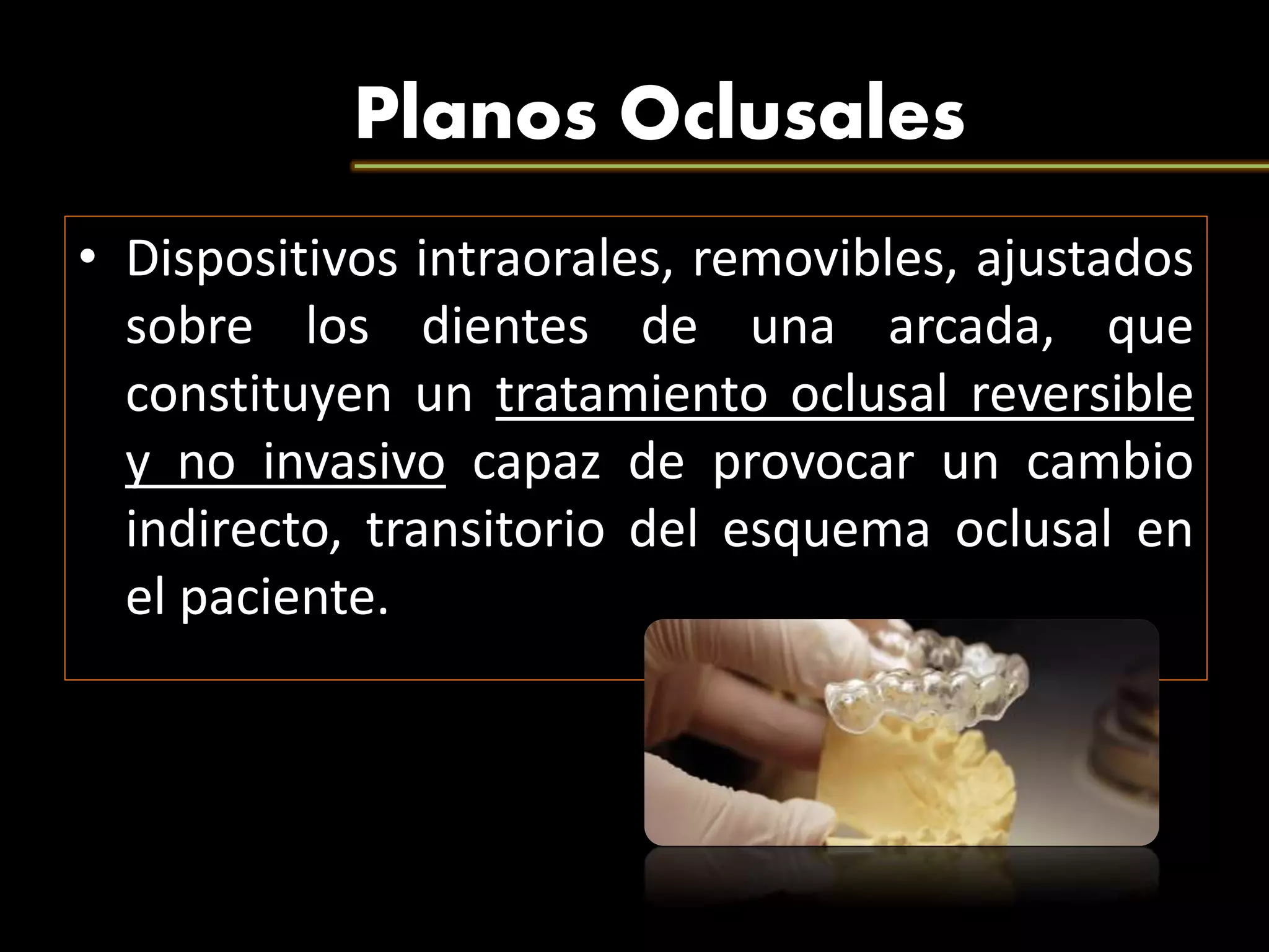 Selección e indicaciones de planos oclusales | PPT