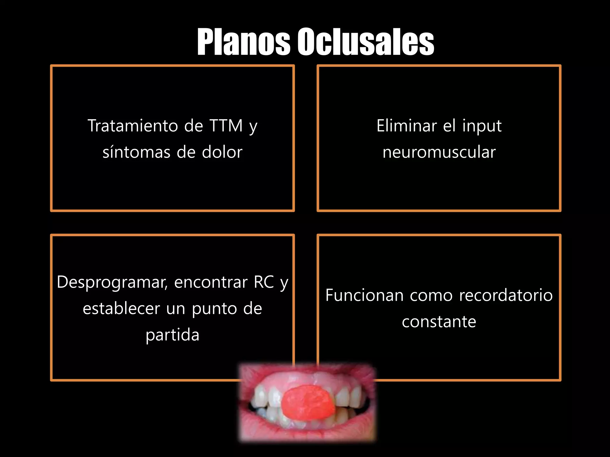 Selección e indicaciones de planos oclusales | PPTX