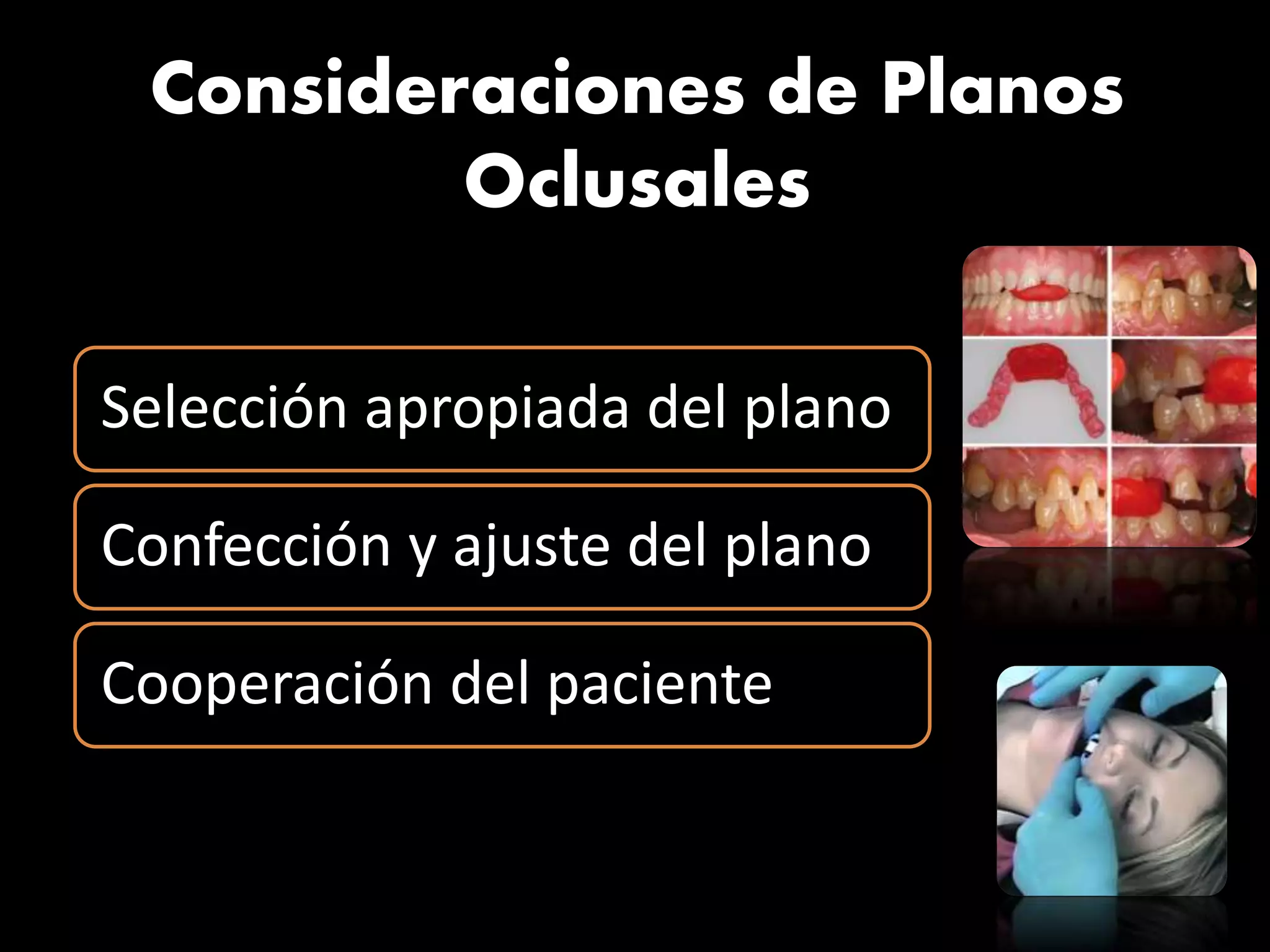 Selección e indicaciones de planos oclusales | PPT