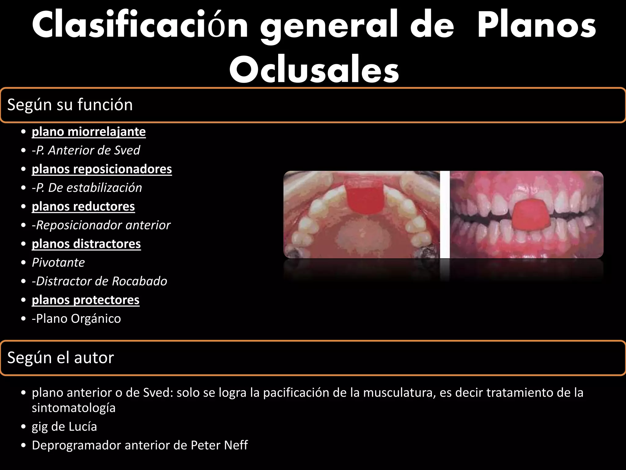 Selección e indicaciones de planos oclusales | PPTX
