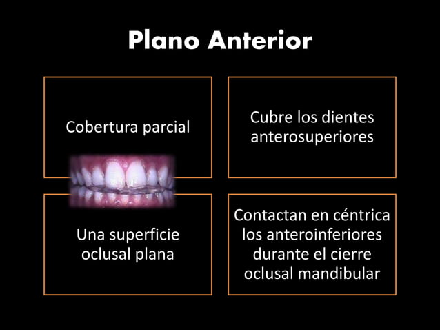 Selección e indicaciones de planos oclusales | PPTX