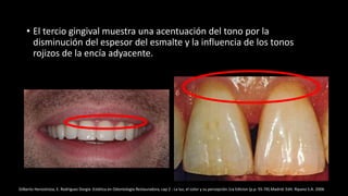 SELECCIÓN DE COLOR EN ODONTOLOGIA / R.O | PPTX