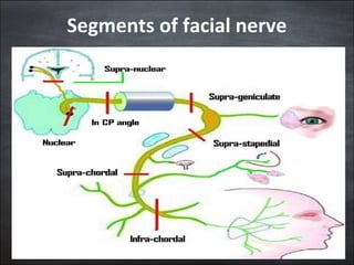 Surgical anatomy of facial nerve | PPT