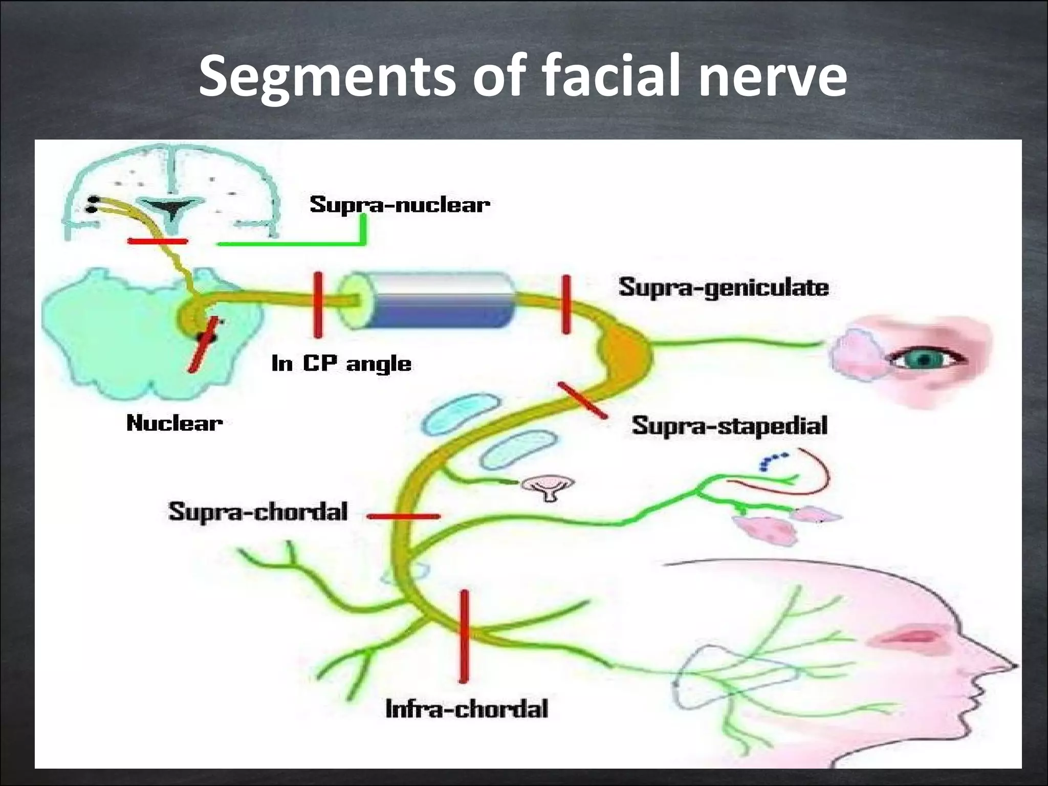 surgical anatomy of facial nerve | PPT