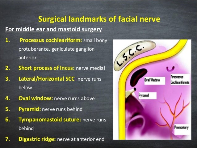 surgical anatomy of facial nerve