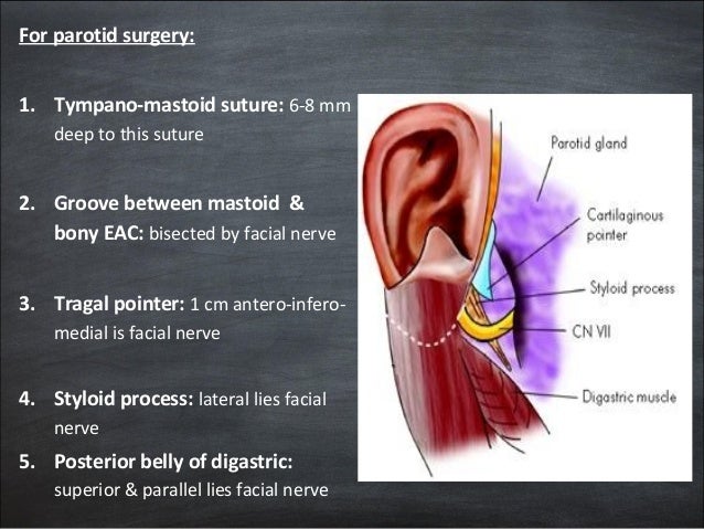 surgical anatomy of facial nerve