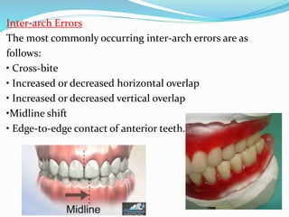 Selection and arrangement of artificial teeth | PPTX