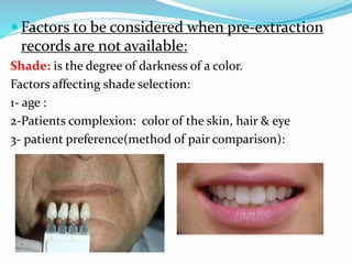 Selection and arrangement of artificial teeth | PPTX