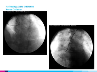Kwan TW - AIMRADIAL 2014 Technical - Selection of catheters | PPT