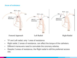 Kwan TW - AIMRADIAL 2014 Technical - Selection of catheters | PPTX