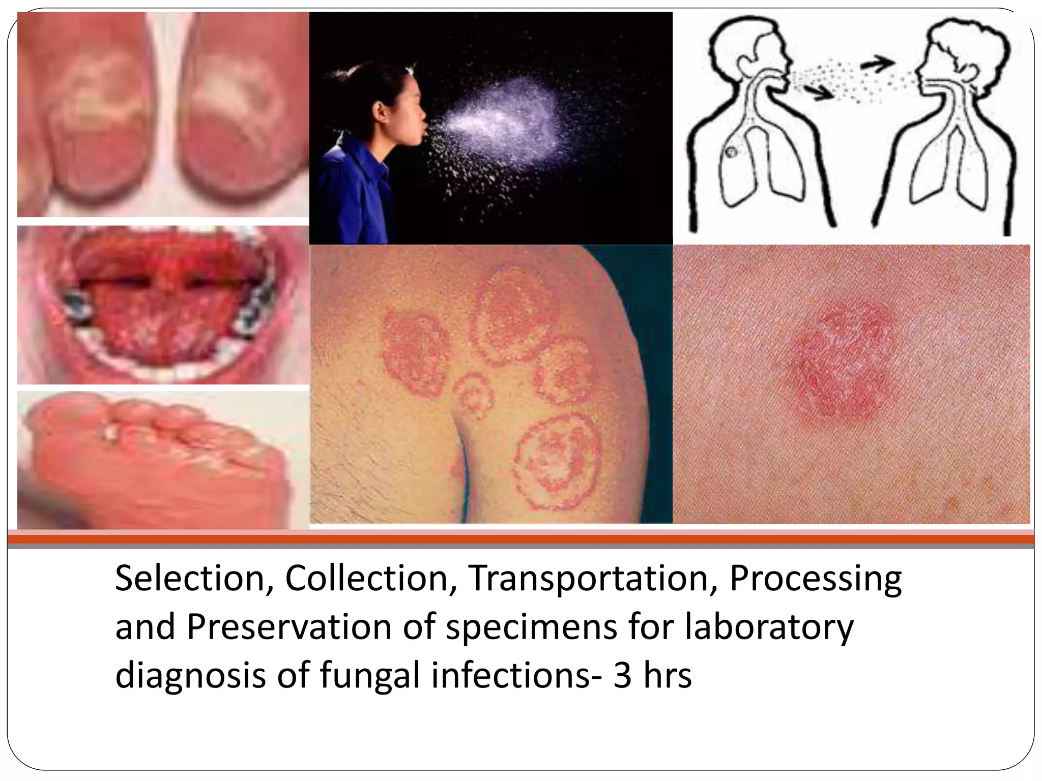 Selection ,collection, transportation and processing of mycology ...