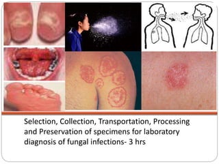Selection ,collection, transportation and processing of mycology ...