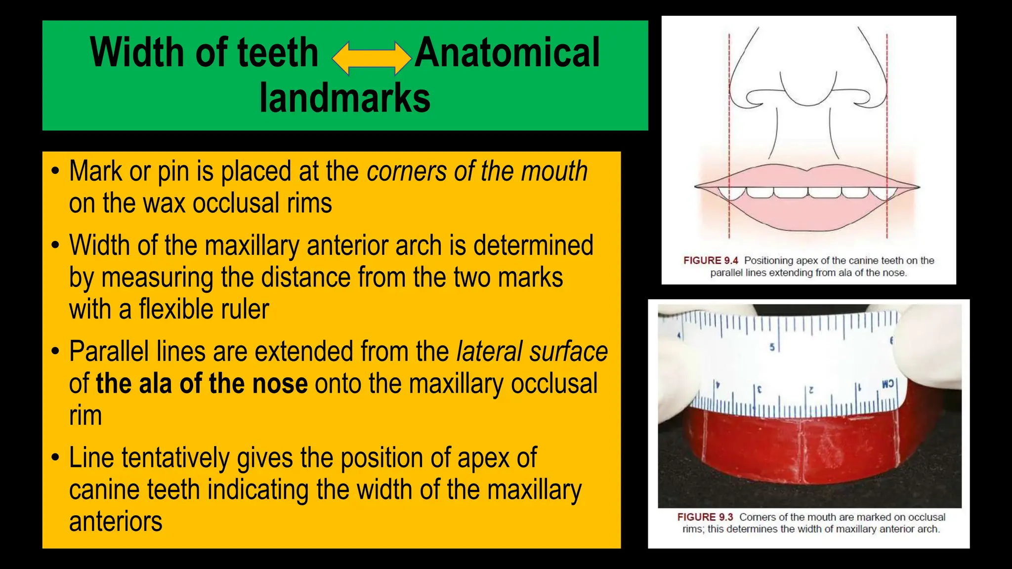 SELECTION OF ANTERIOR TEETh in complete denture | PPTX