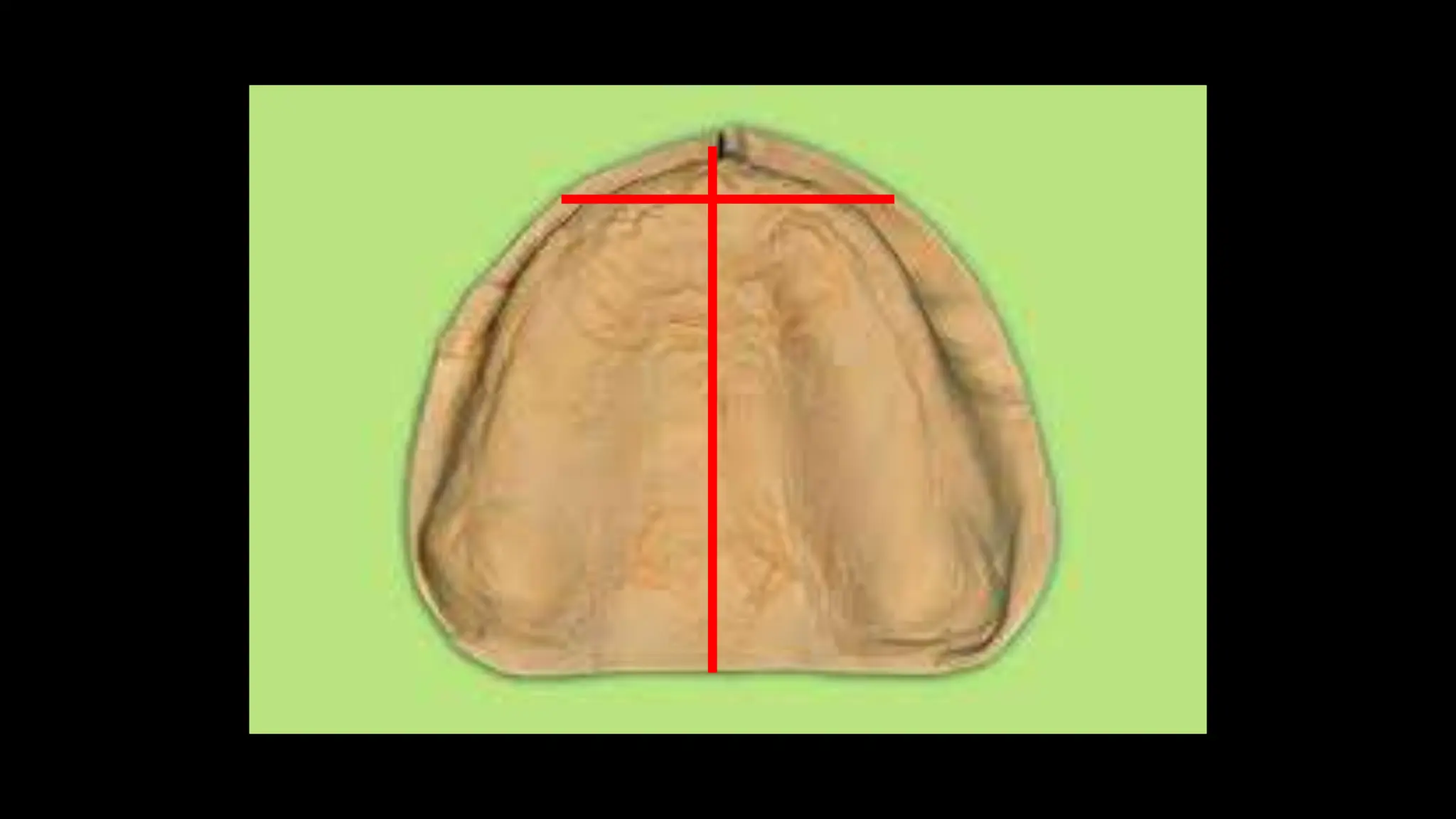 SELECTION OF ANTERIOR TEETh in complete denture | PPTX