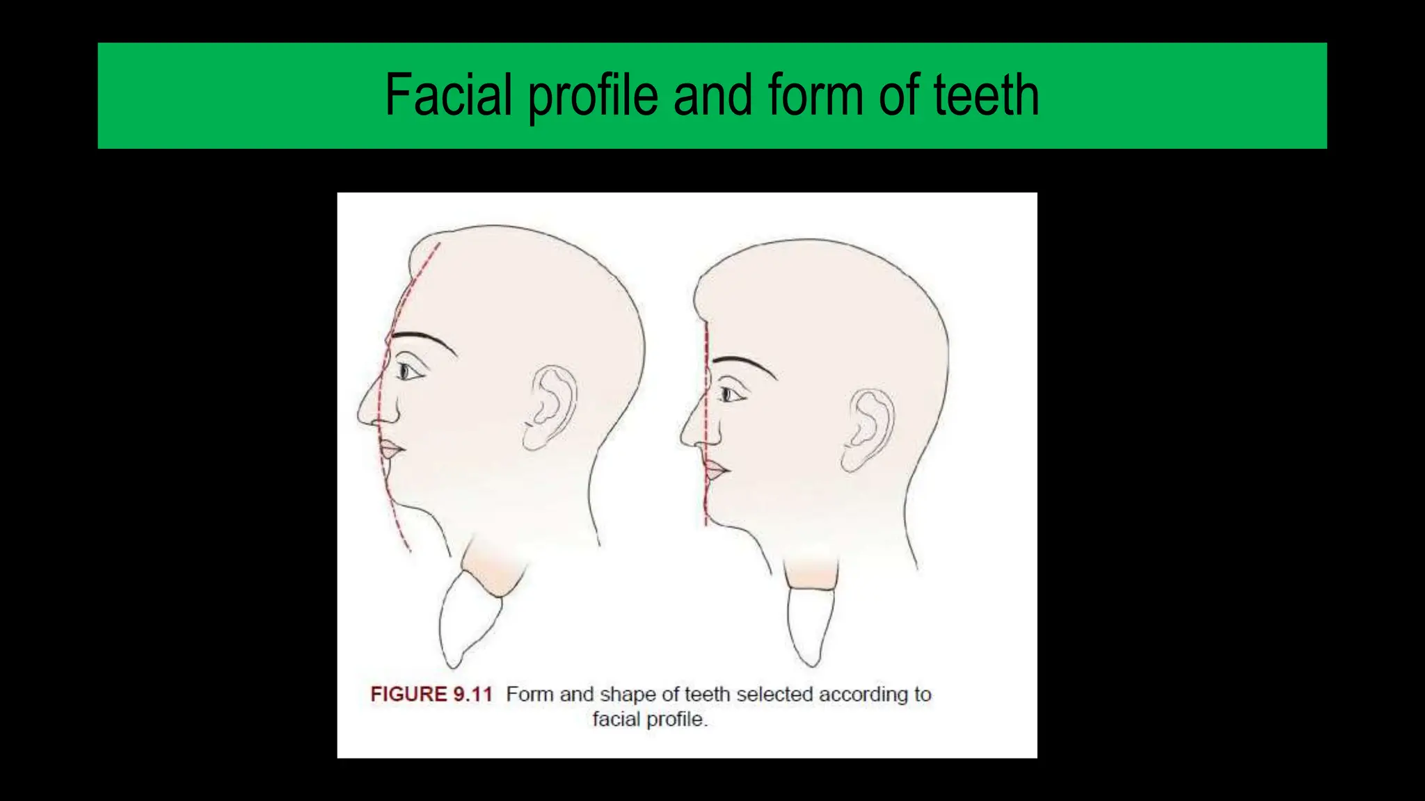 SELECTION OF ANTERIOR TEETh in complete denture | PPTX
