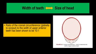 SELECTION OF ANTERIOR TEETh in complete denture | PPTX