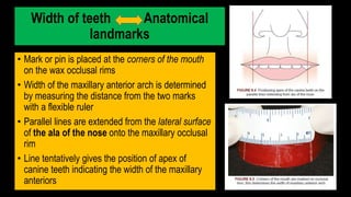 SELECTION OF ANTERIOR TEETh in complete denture | PPTX