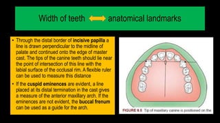 SELECTION OF ANTERIOR TEETh in complete denture | PPTX