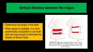 SELECTION OF ANTERIOR TEETh in complete denture | PPTX