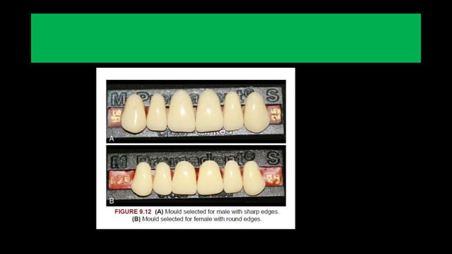 SELECTION OF ANTERIOR TEETh in complete denture | PPTX