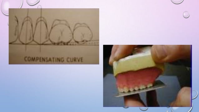 Selection of artificial teeth | PPTX
