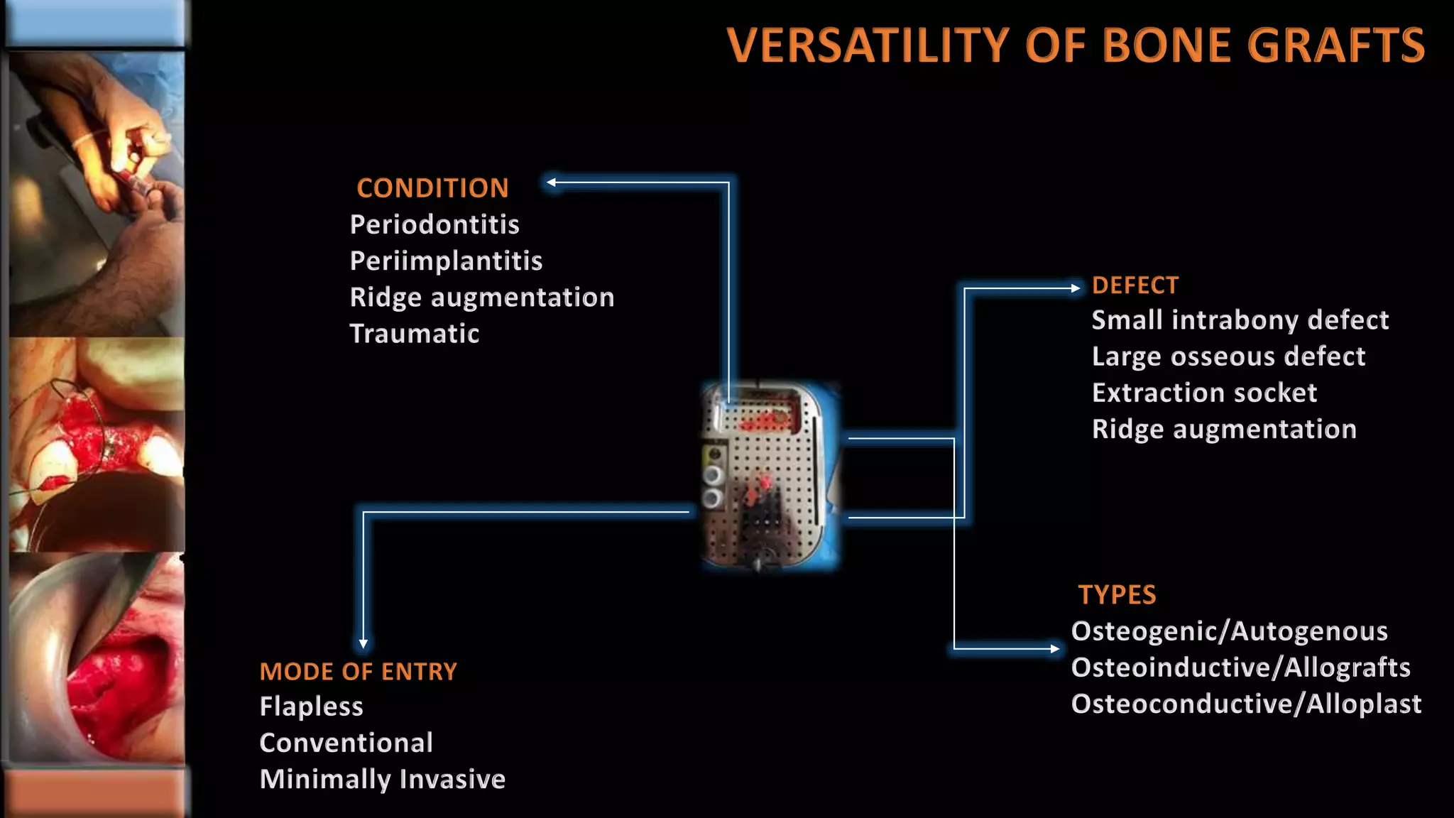 Selection of bone grafts in periodontics | PPTX | Dental Health ...