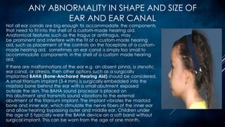 Selection of Hearing Aid | PDF