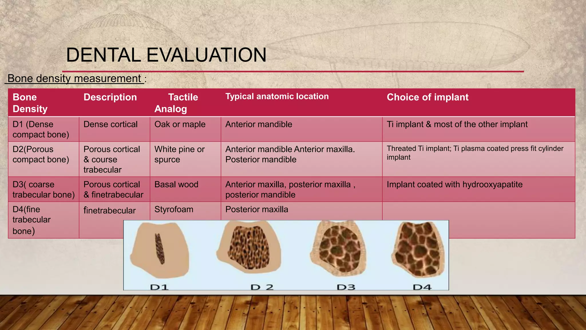 Selection of patient for dental implant | PPTX