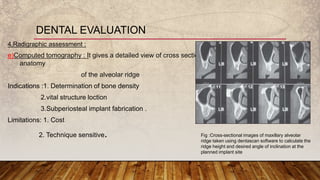 Selection of patient for dental implant | PPTX