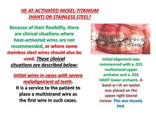 Preformed Archwire Spring Ballista