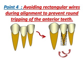 Preformed Archwire Spring Ballista