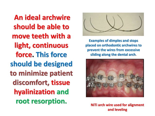 selection of preformed arch wires during the alignment stage of ...