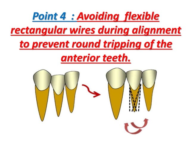 selection of preformed archwires during the alignment stage of ...