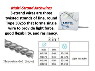 Preformed Archwire Spring Ballista